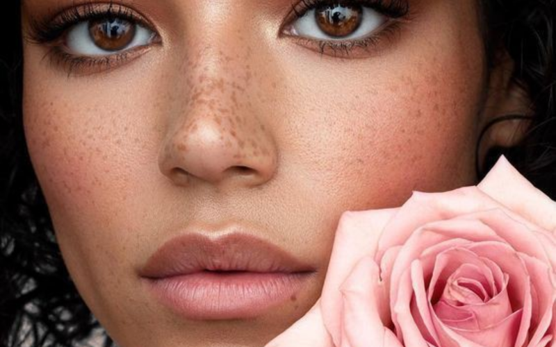 Myth – Age Spots Or Dark Spots Are Just A Sign Of Early Aging – Ozone ...